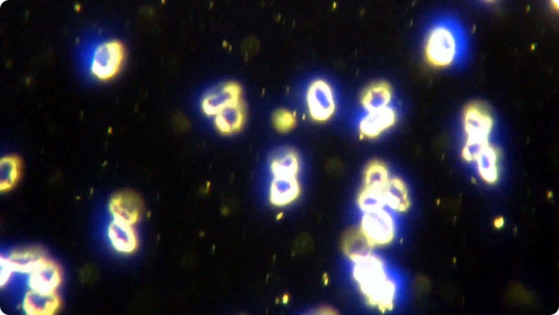 Zombie Blood - COVID19 Embalmed Blood For Over 2 Years Shows Continued ...